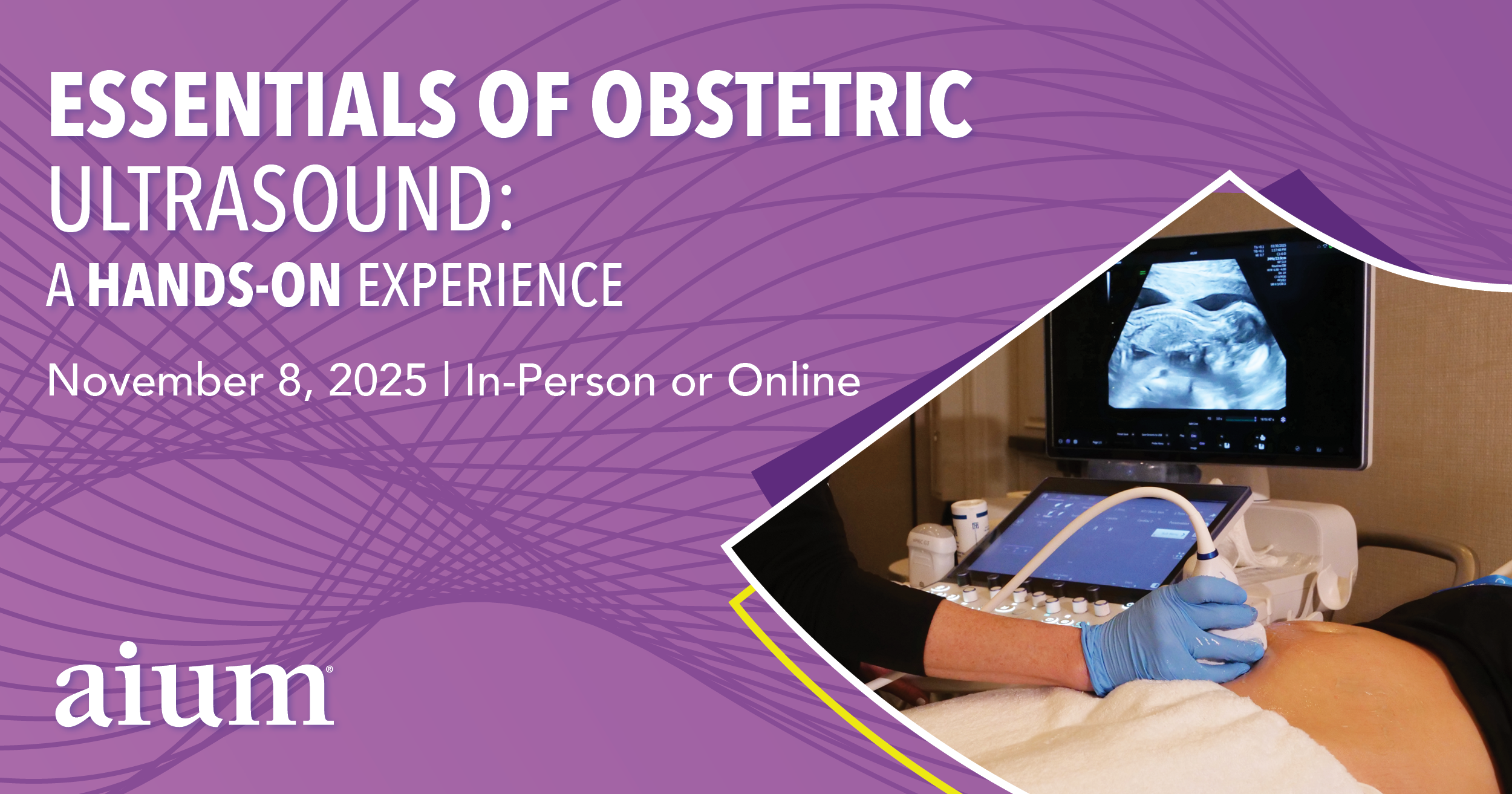 Essentials of Obstetric Ultrasound A Hands-On Experience